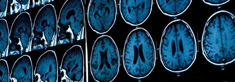 Best MRI Viewer Online Software & Apps | Architectures Lab