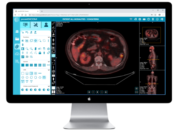 Instantly Access and Analyze Medical Images: Meet the Game-Changing Online DICOM Viewer ...